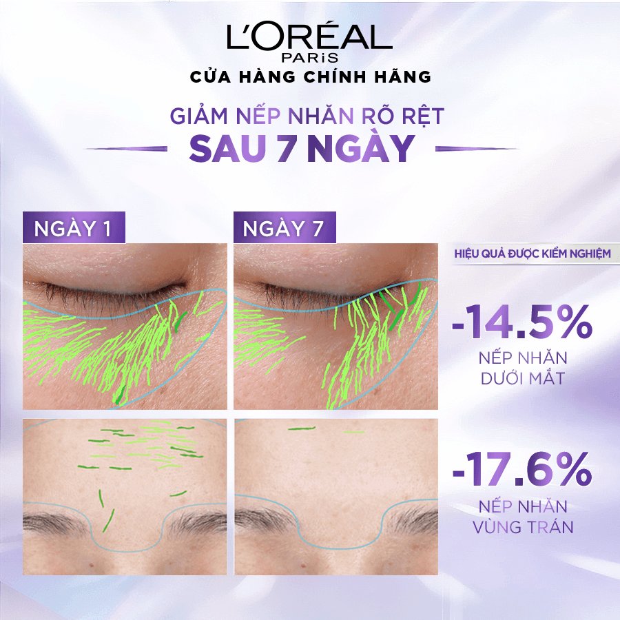 Dưỡng chất Revitalift HA 1.5% 30ml | L'Oreal Paris